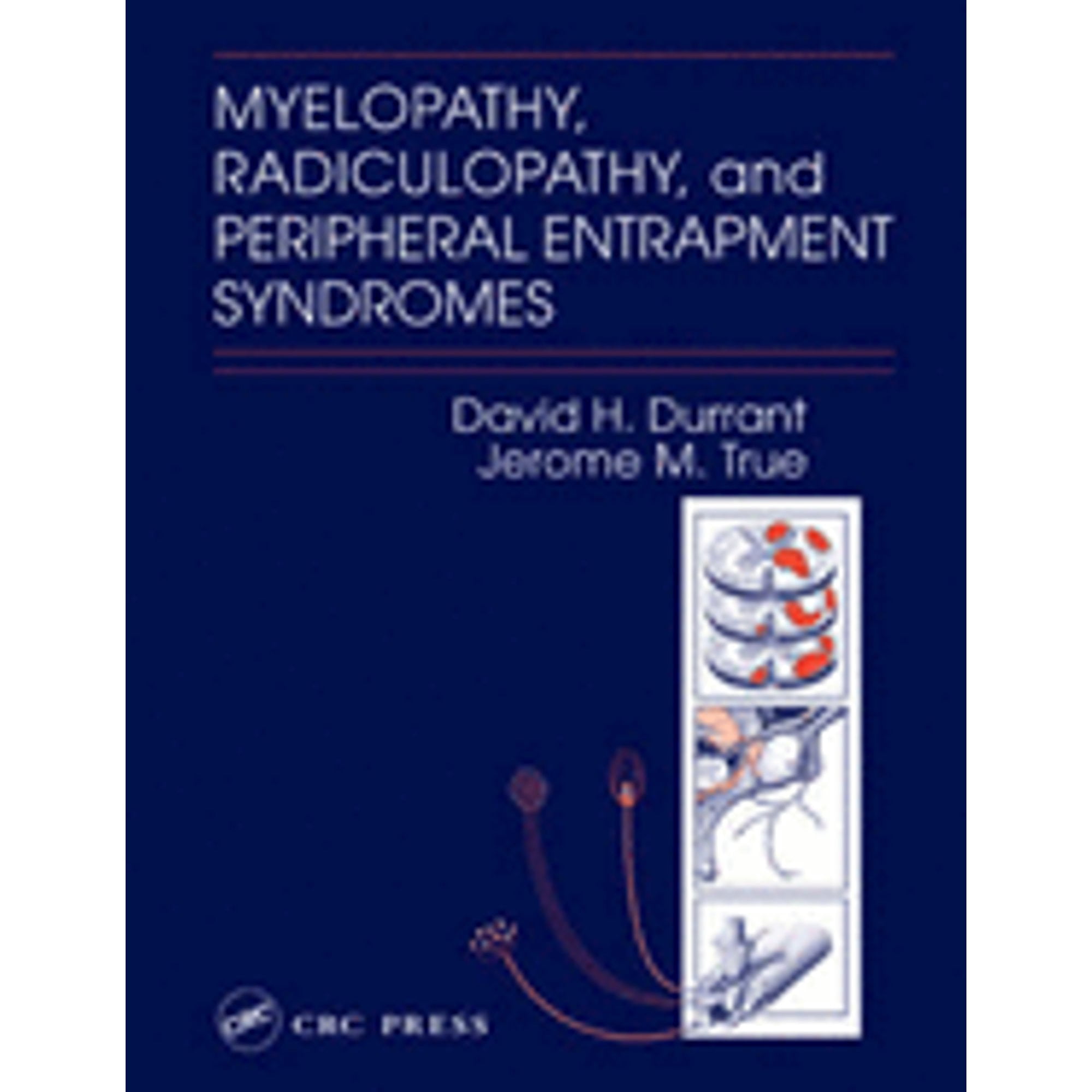Pre-Owned Myelopathy, Radiculopathy, and Peripheral Entrapment ...