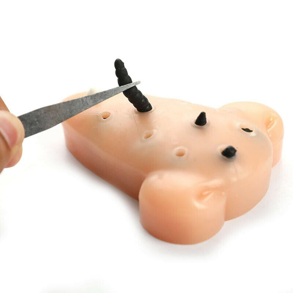 NATEFEMIN Adorable Pimple Popping Toy Safe, Non-Toxic TPE, Designed for ...