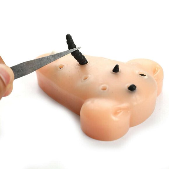 Pimple Popping Toy