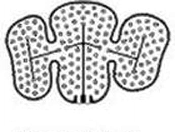 Ossur Cold Rush Hip Pad Left HSA/FSA Eligible - Walmart.com