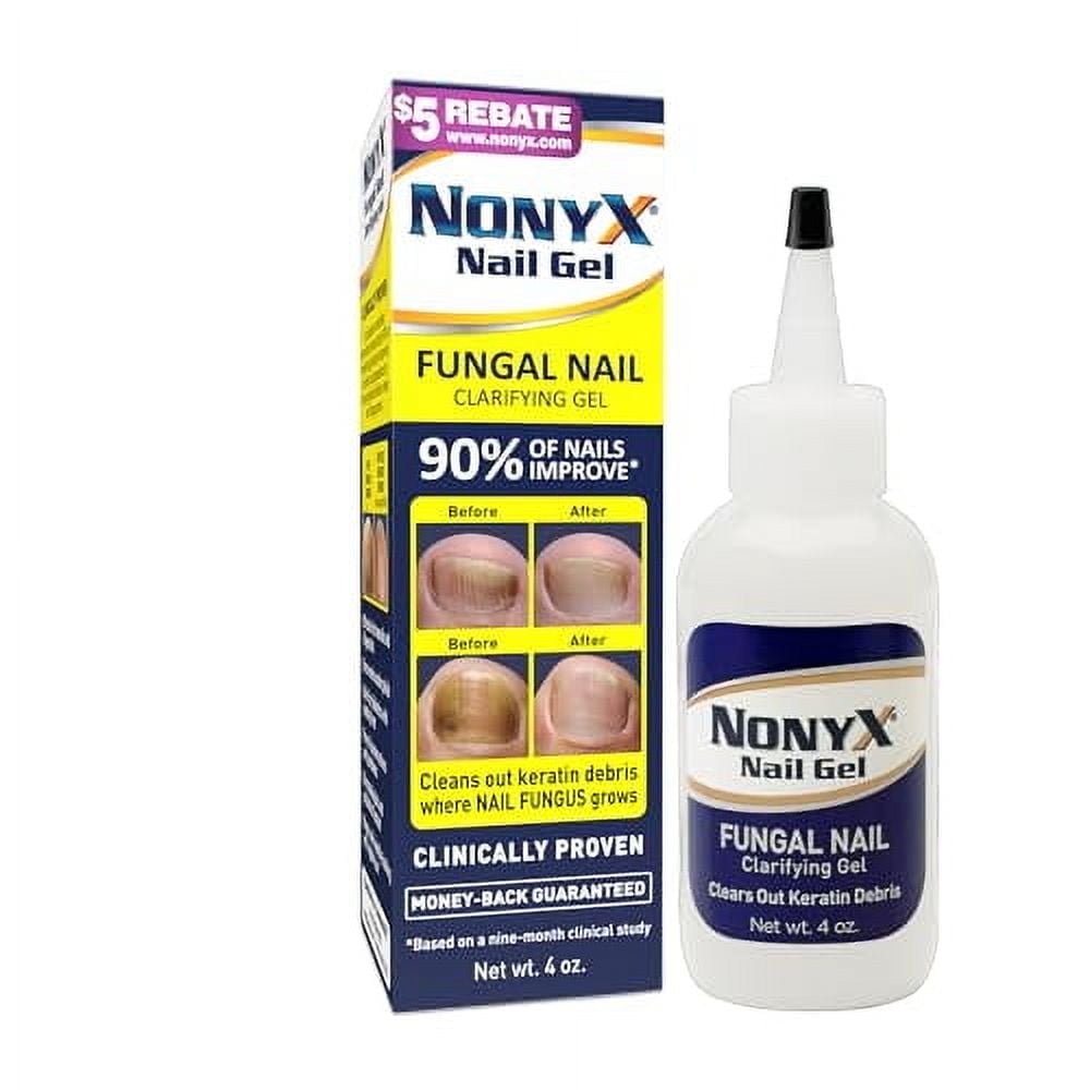 NONYX Fungal Nail Clarifying Gel | Rids Nails of Fungus by Removing ...