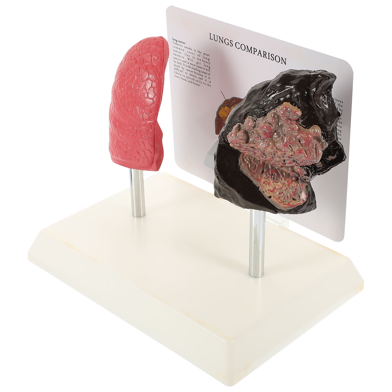 NUOLUX 1Pc Multi Lung Anatomical Model PVC 7.9X5.5X5.5in for Smokers Lung Patient Education ...