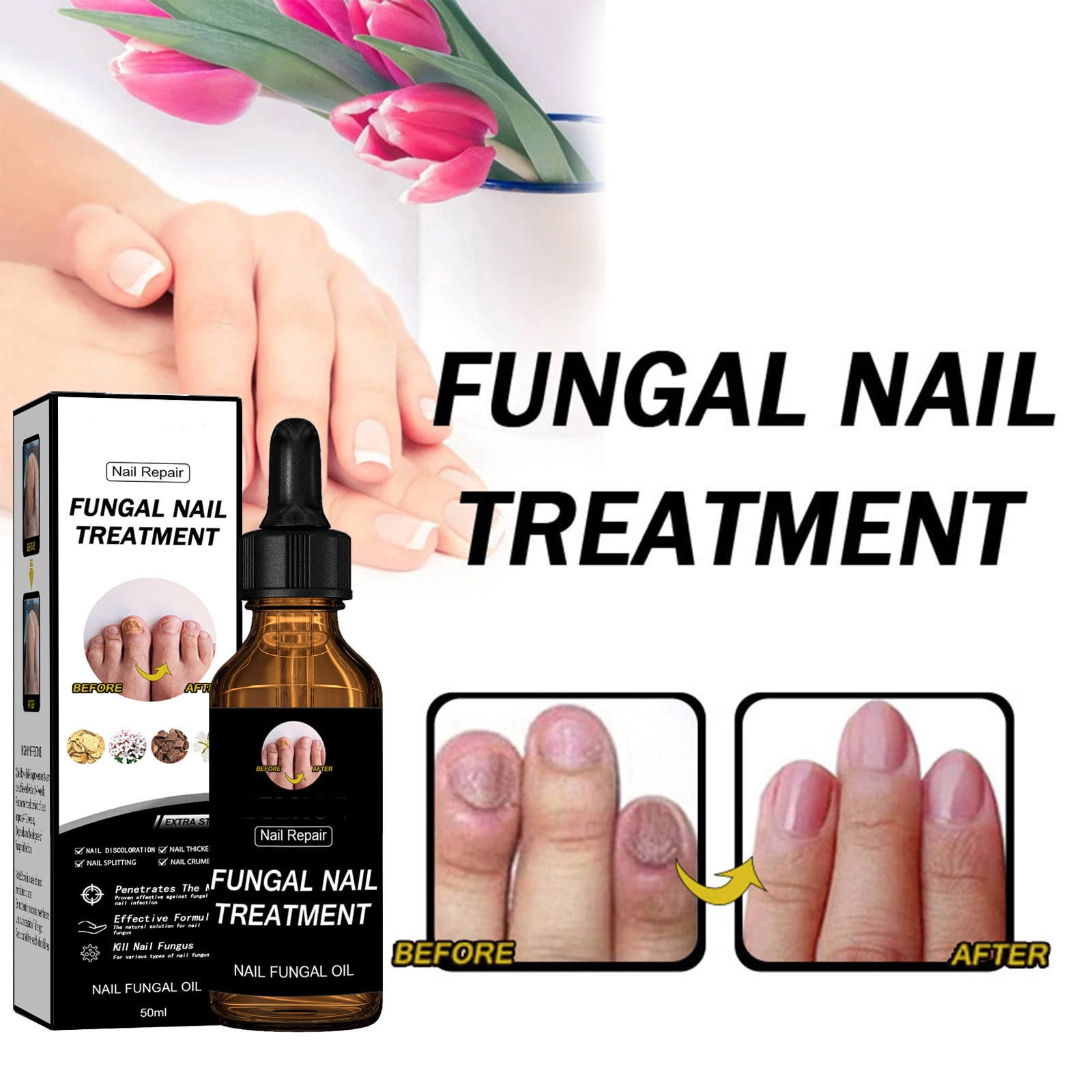 Nail for Acrylic Nails with Guard Nail Lotion Drops Thickening And ...