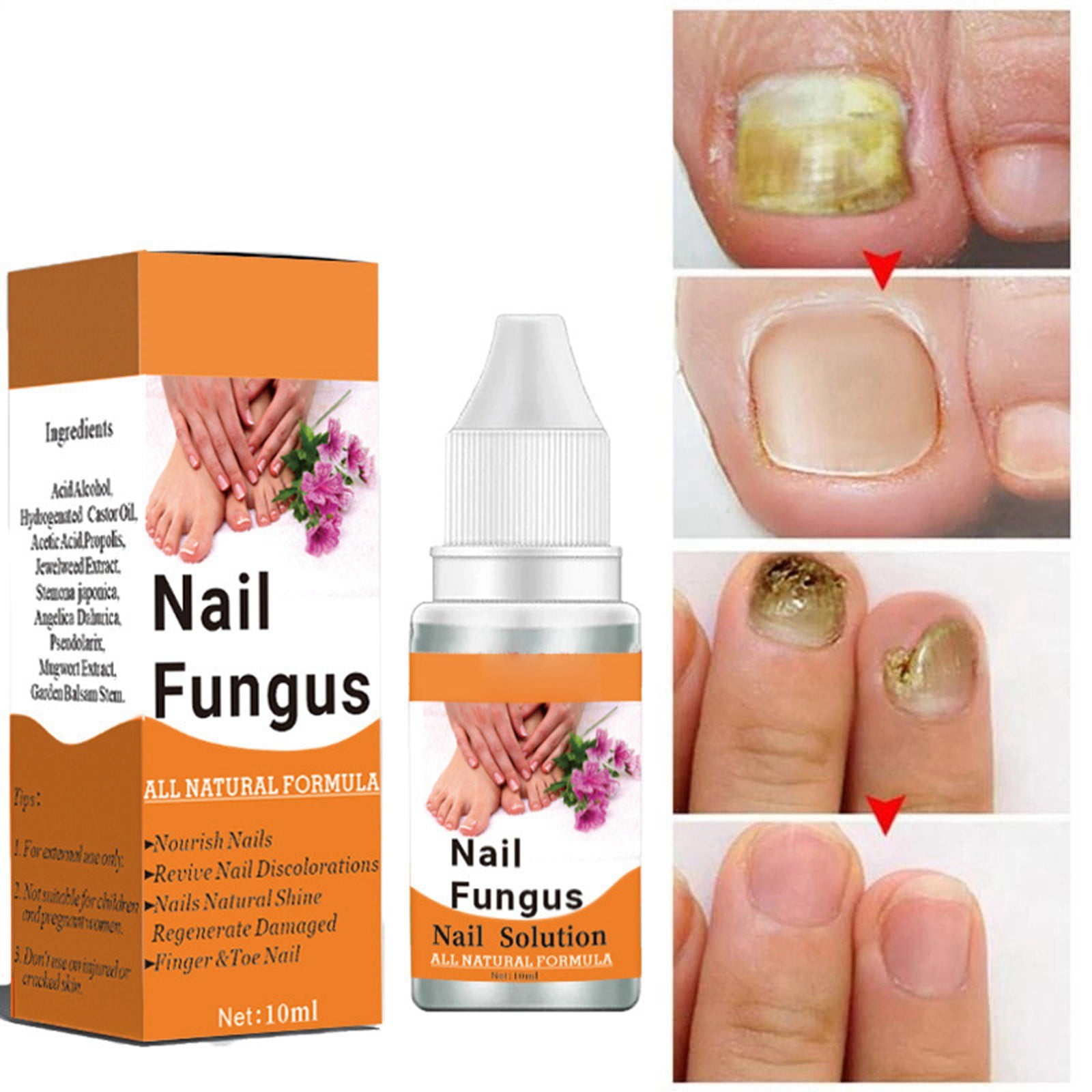 Nail Care Solution For Hand And Foot 10Ml Beautiful Practical Easy To ...