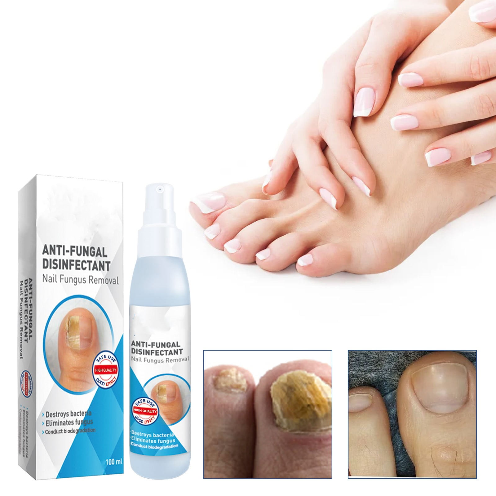 Nail Care Spray, Athlete's Foot Spray, Strengthening Formula Against ...