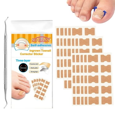 Stainless Steel Ingrown Toenail Corrector Paronychia Treatment ...