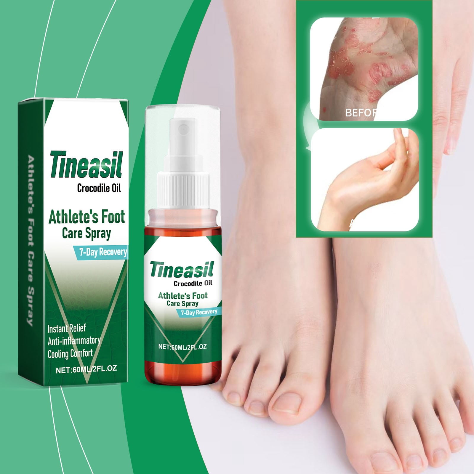 Nail Cuticle Remover Smooth Feet Dried Peel Dry Skin Remover for Feet ...