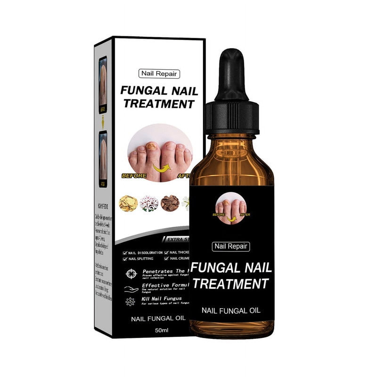 Nail Fungal Treatment Kerassentials Toenail Treatment Oil Fungal Nail