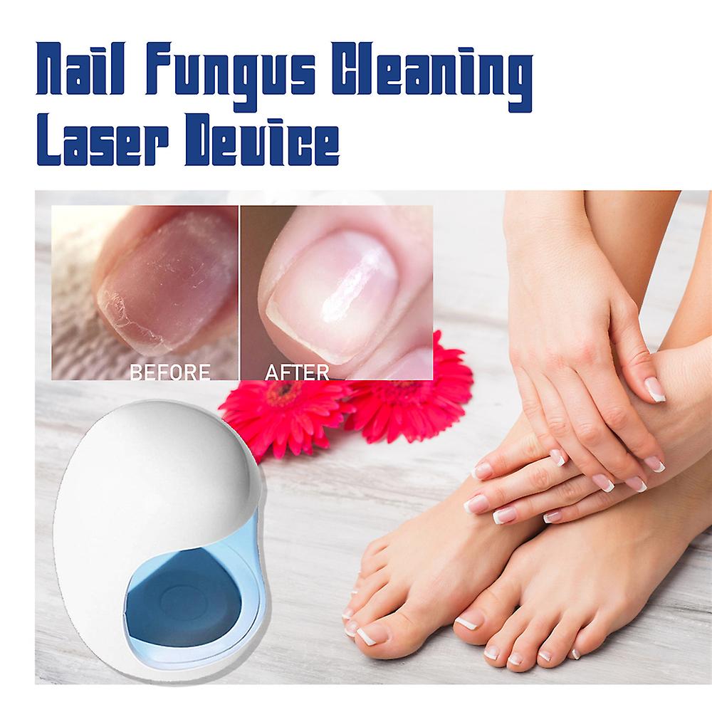 Nail Fungus Laser Treatment Device Usb Charging Fingernails Toenails ...