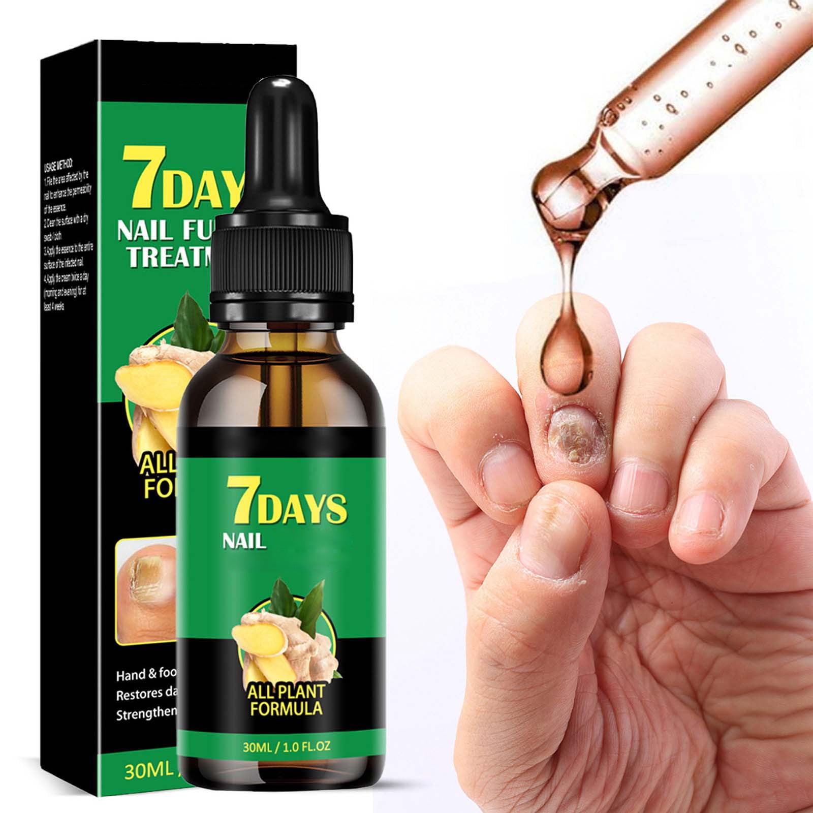 Nail Fungus Treatment,Ginger Nail Care Liquid,7 Days Nail Fungus Treatment Essence Serum Anti ...