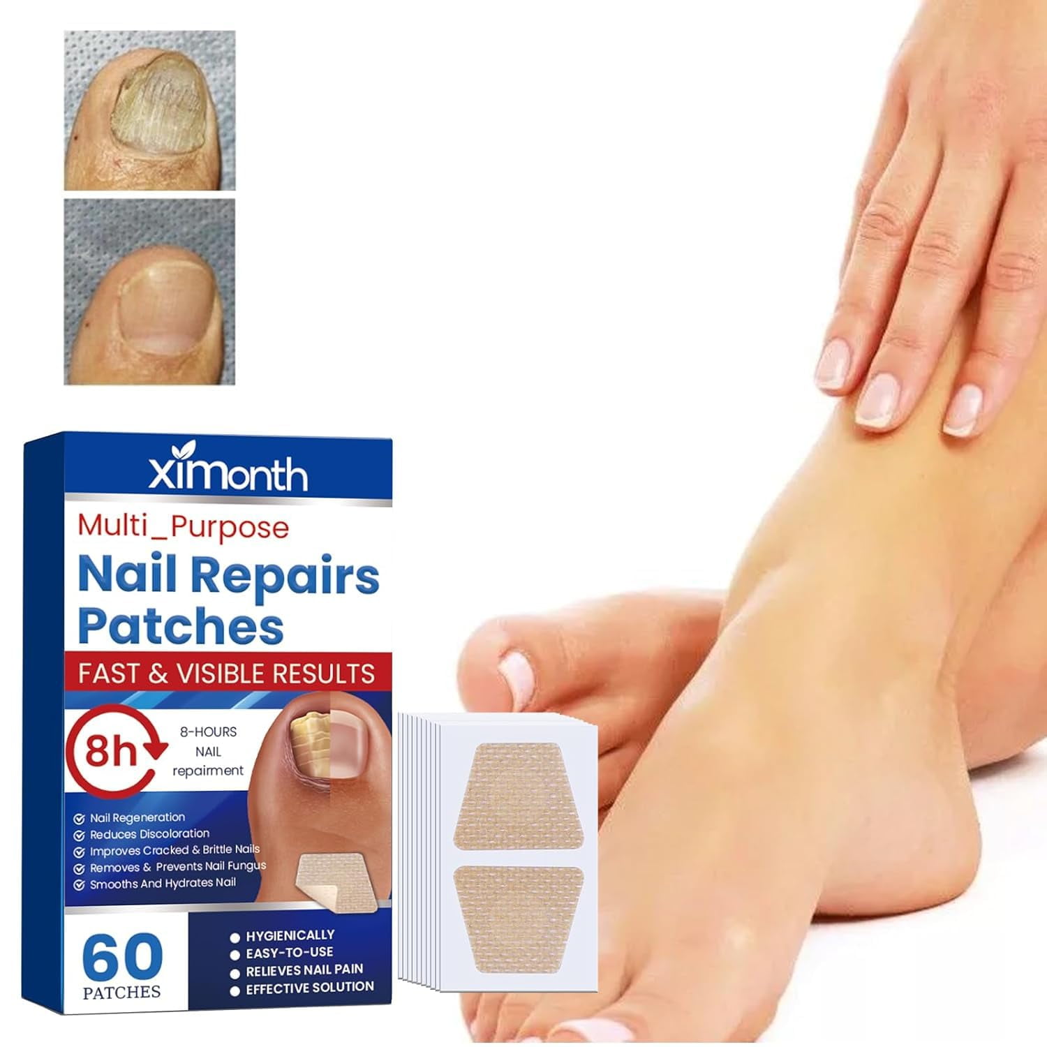 Nail Patches - Toenail Care for Toenail Fingernails - 8-Hour Nightime N ...