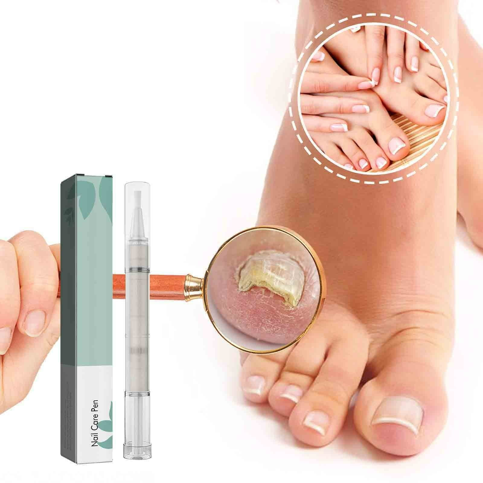 Nail Pencil for Whitening Under Nails, Beauty under $10 Nail Care ...