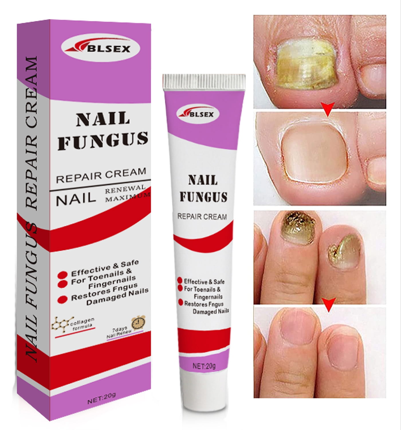 AIDAIMZ Toenail Treatment with Tea Tree Oil - Fingernail and Toe Nail ...