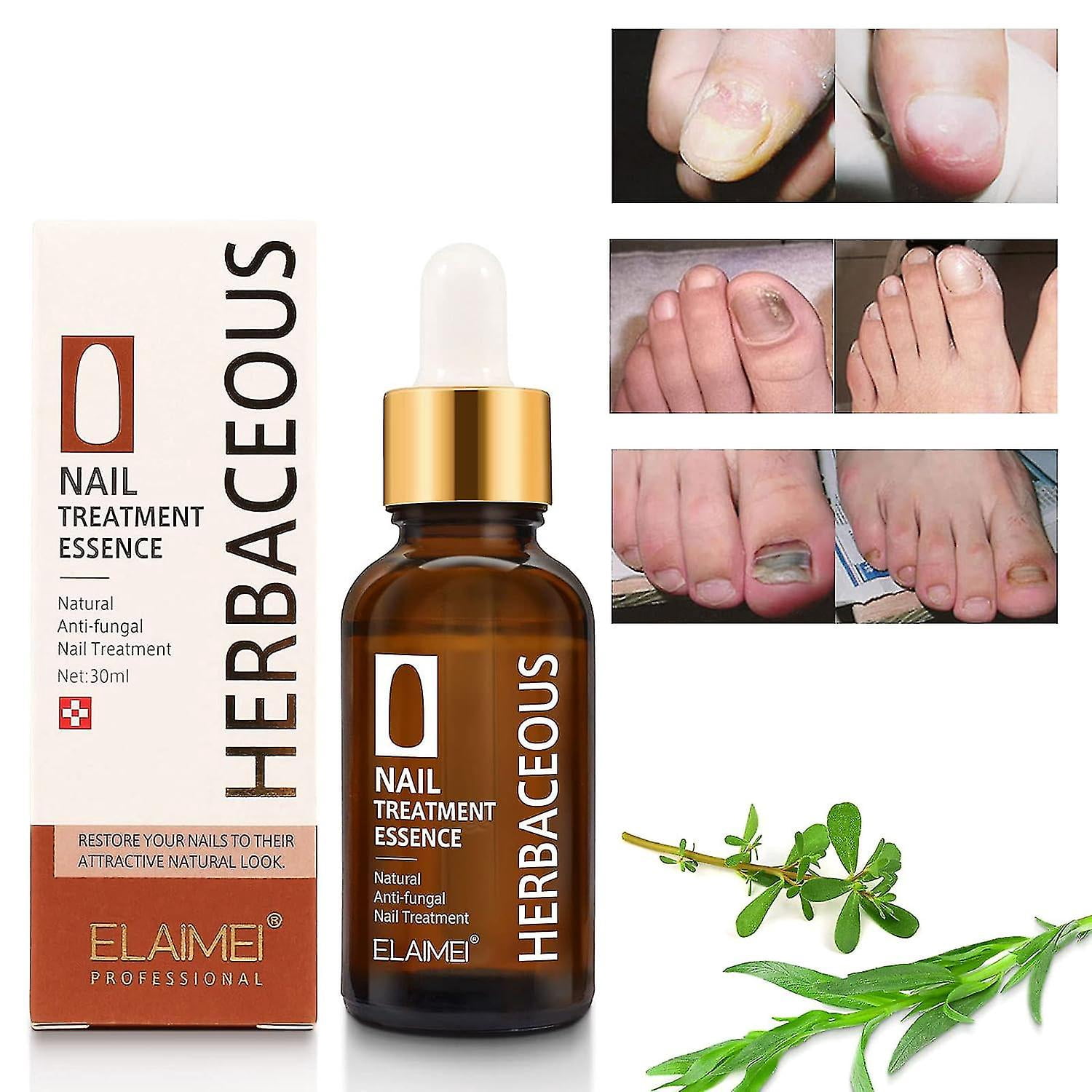 Nail Renewal Serum For Damaged Nails, Nail Growth And Strengthening ...