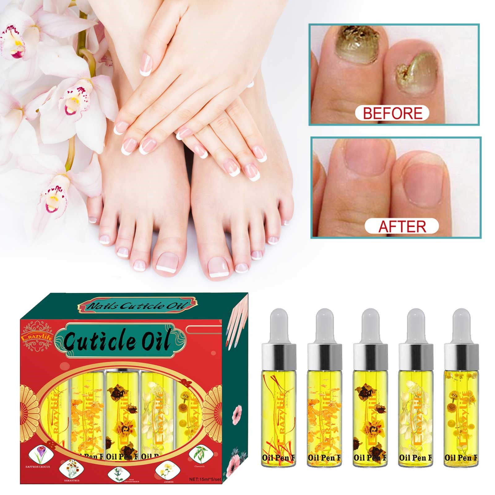 Nail Repair Toenail Pen Toenail And Nail Care Nail Support Grey Nail ...