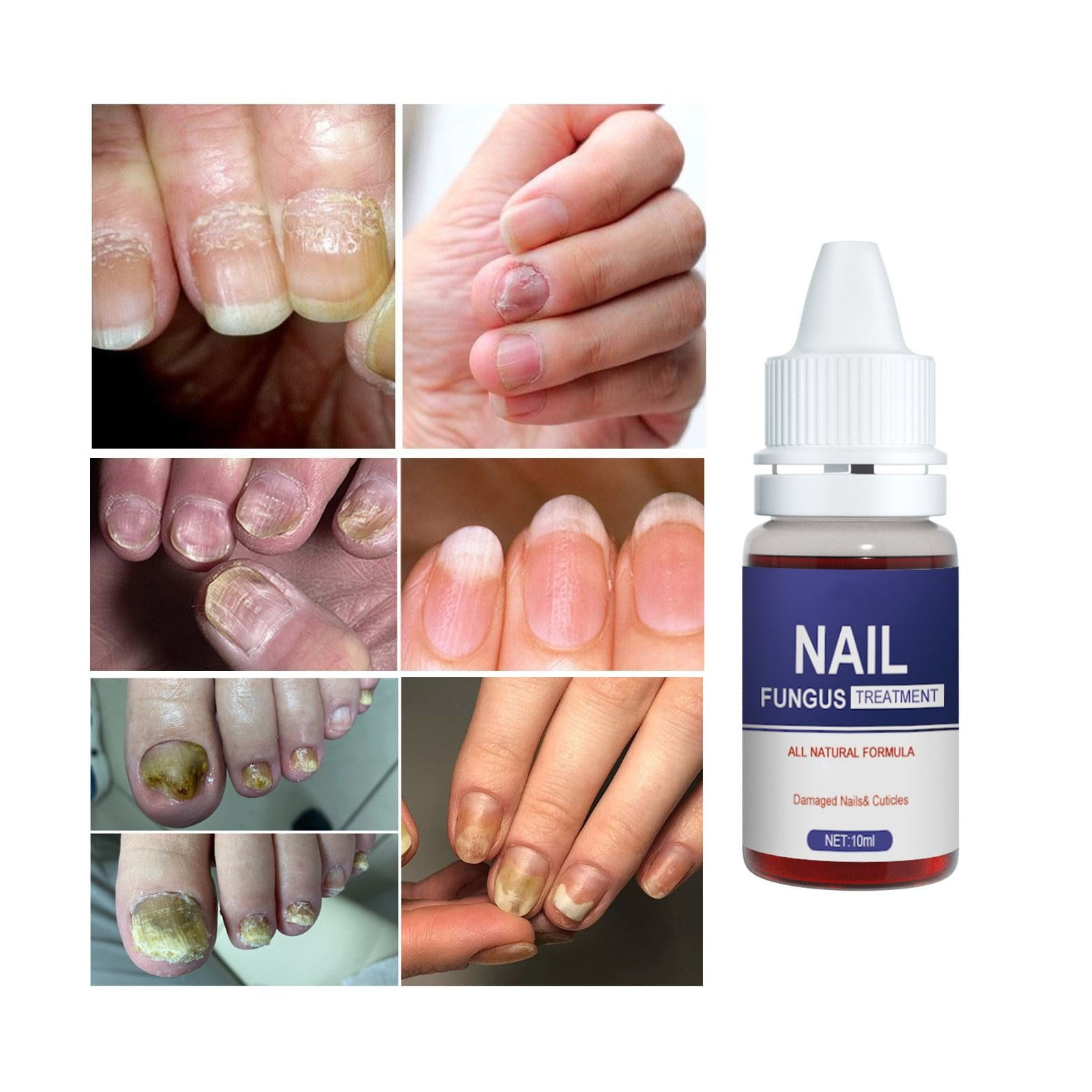Nail Solution And Thicken Nails Soft Nail Polish Nail Care Soft Gel ...