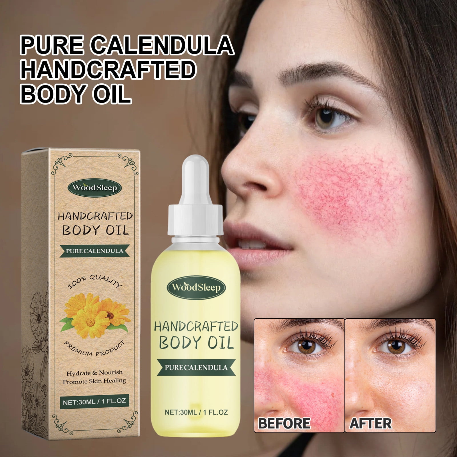 Natural Calendula Oil, Handcrafted Body Oil, 30ml Size, Pure Plant ...