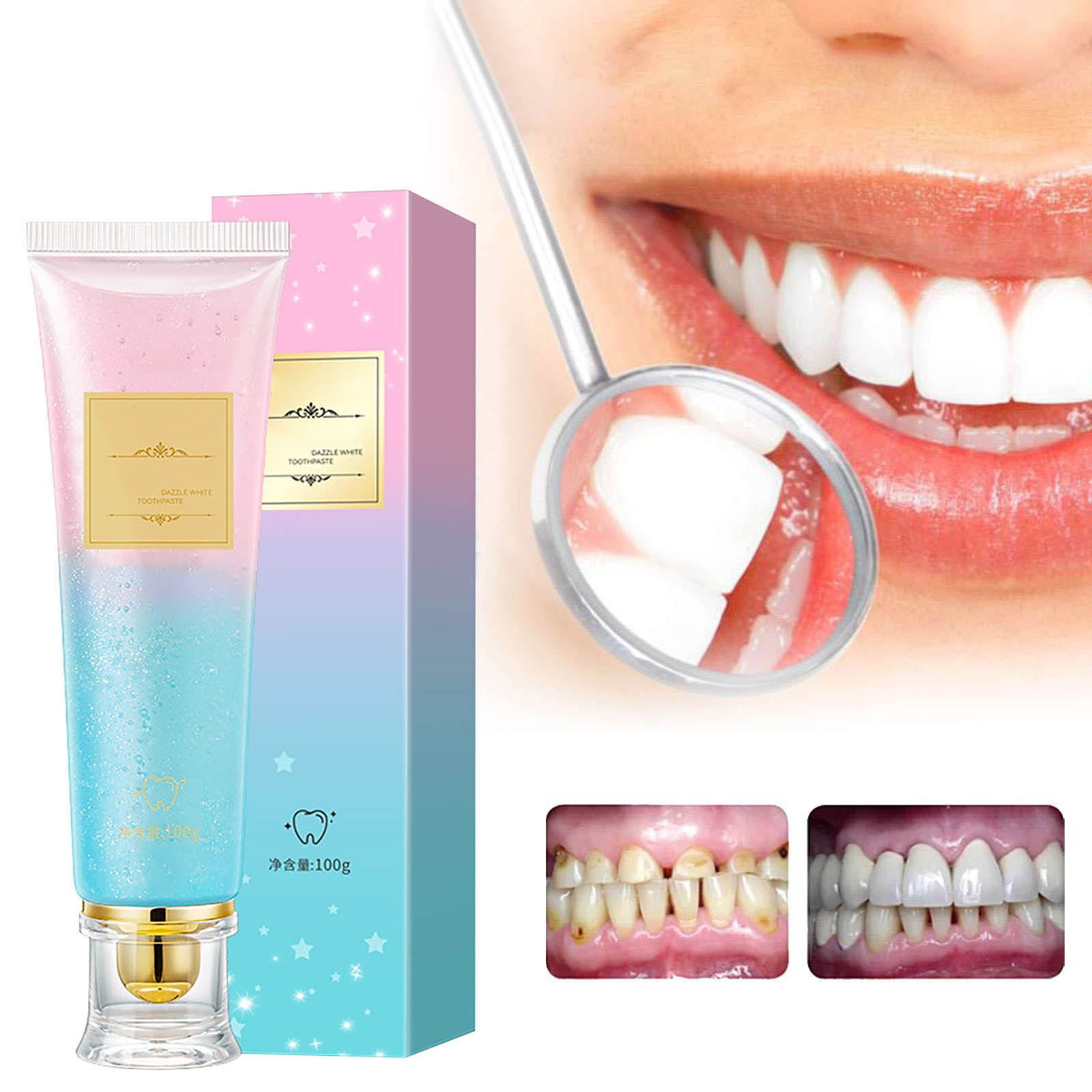 Natural Whitening Toothpaste with Baking Soda - Intensive Stain Removal ...