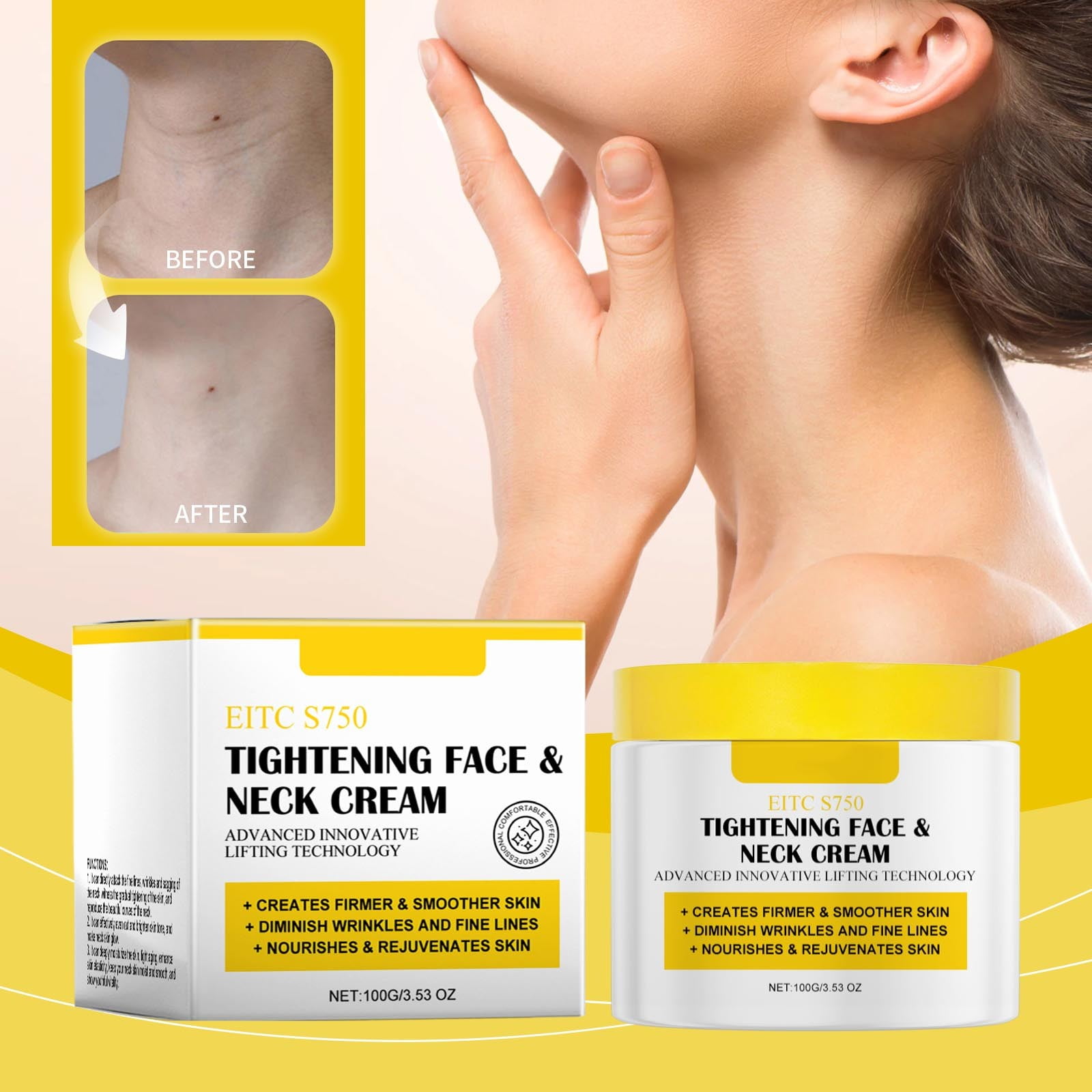 Neck Beauty Neck Lifting Specializes In Effect Care Of Neck Lines And ...