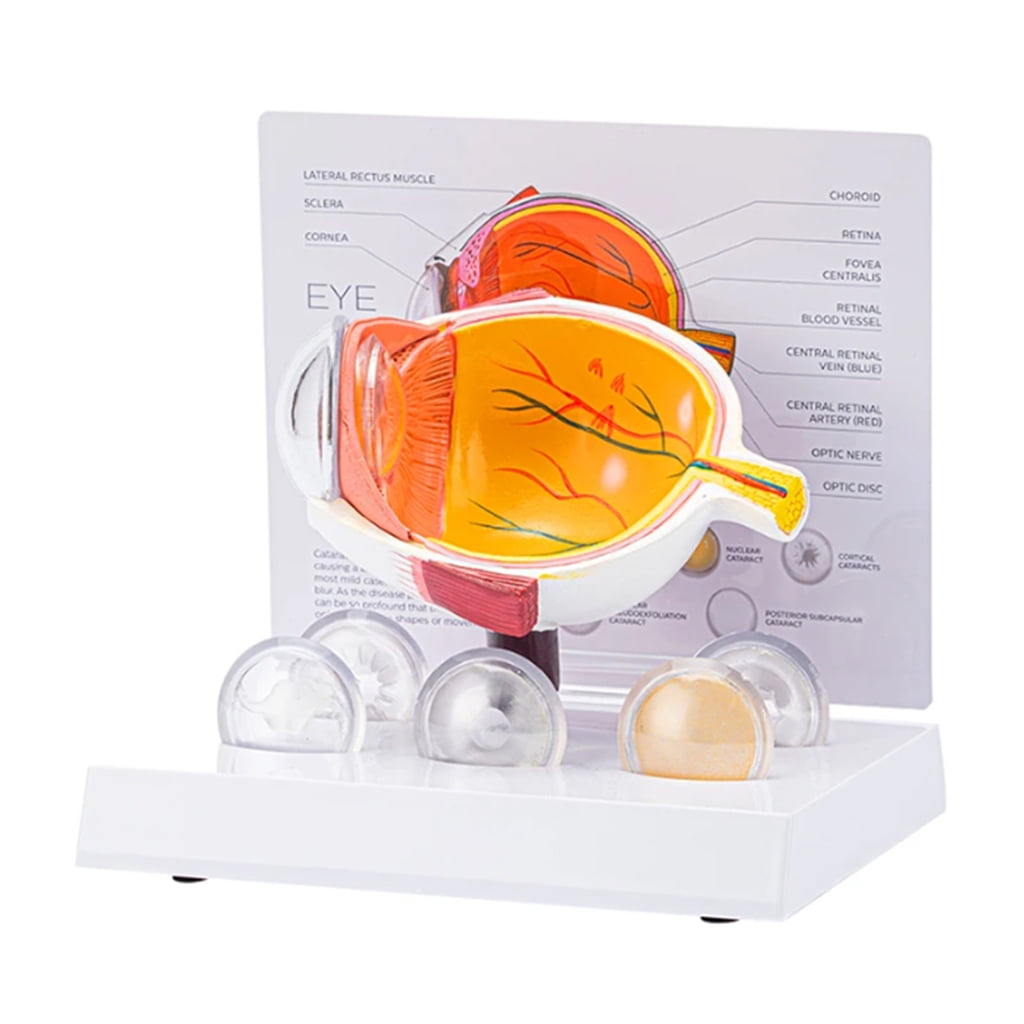 Necvior Human Eye Anatomy Model Anatomical Pathological Eyeball Model ...