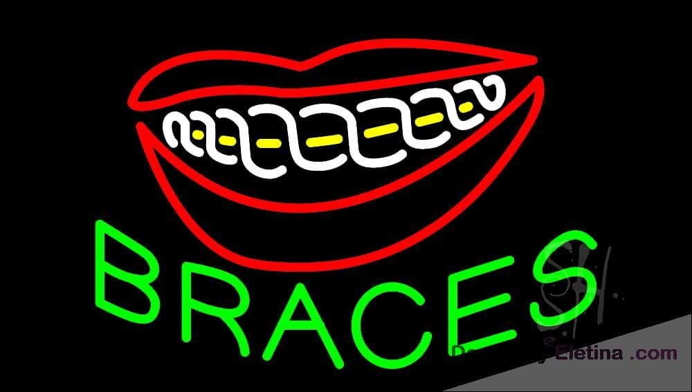 Neon Signs for Wall Decor Braces Logo Sign Neon Led Tubing16x20inch ...