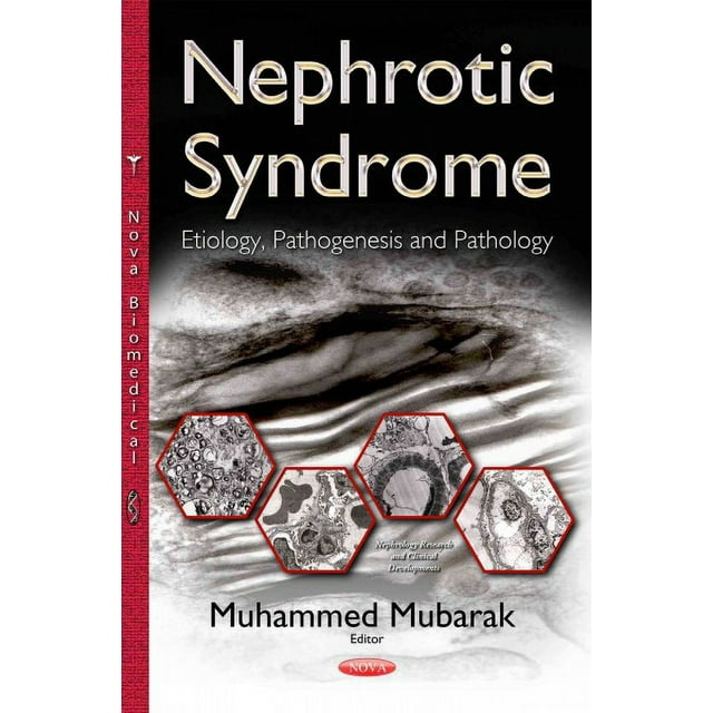 Nephrotic Syndrome : Etiology, Pathogenesis and Pathology - Walmart.com
