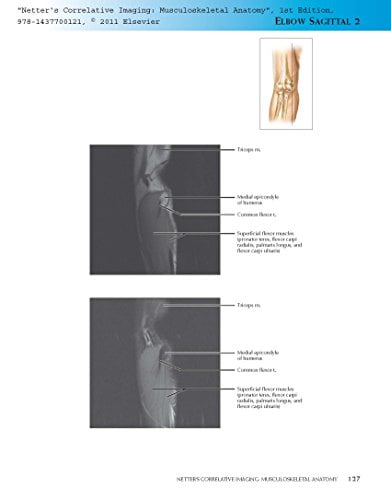 Pre-Owned Netter's Correlative Imaging: Musculoskeletal Anatomy: With ...