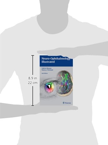 Neuro-Ophthalmology Illustrated Biousse, Valerie and Newman, Nancy J ...