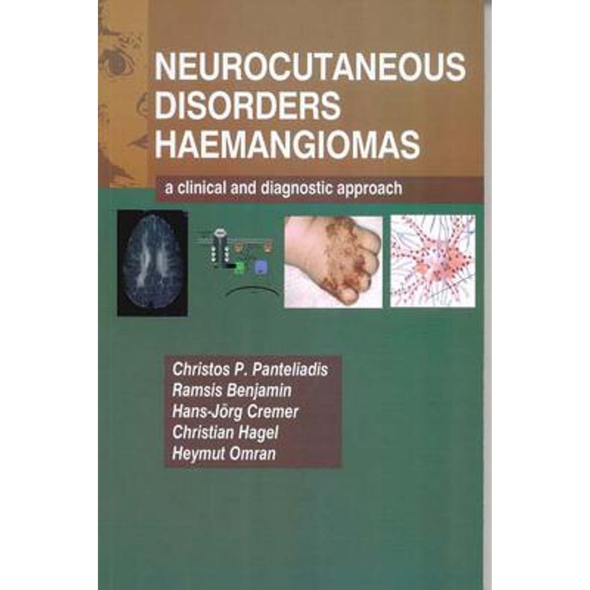 Neurocutaneous Disorders - Hemangiomas: A Clinical and Diagnostic ...