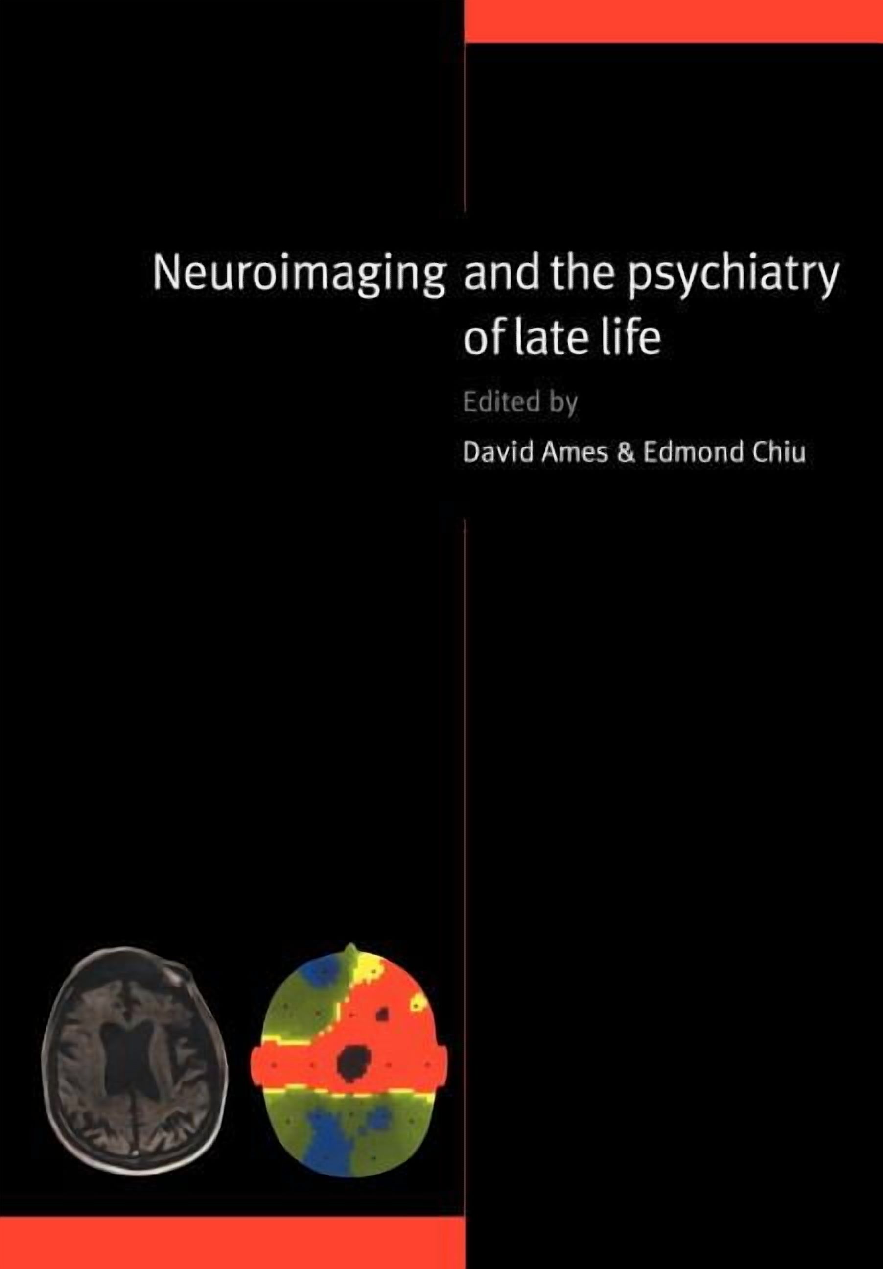 Neuroimaging and the Psychiatry of Late Life, (Paperback) - Walmart ...