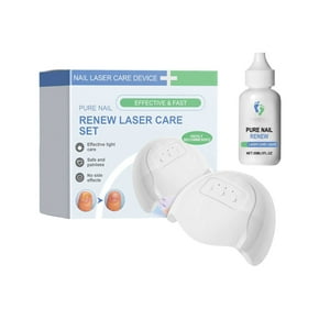 Fungal Toenail Laser Treatment