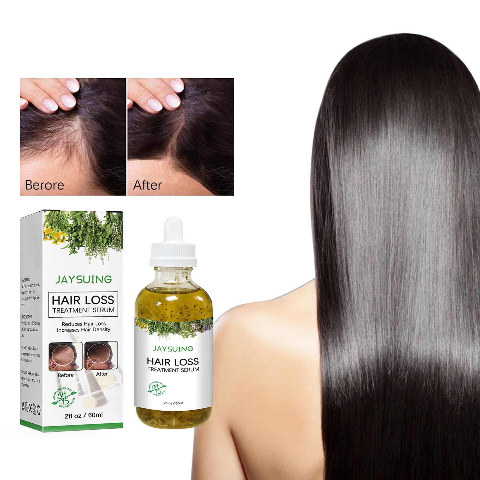 New Release! JGF844 Anti-Hair Loss Conditioner Intensive Hair Growth ...