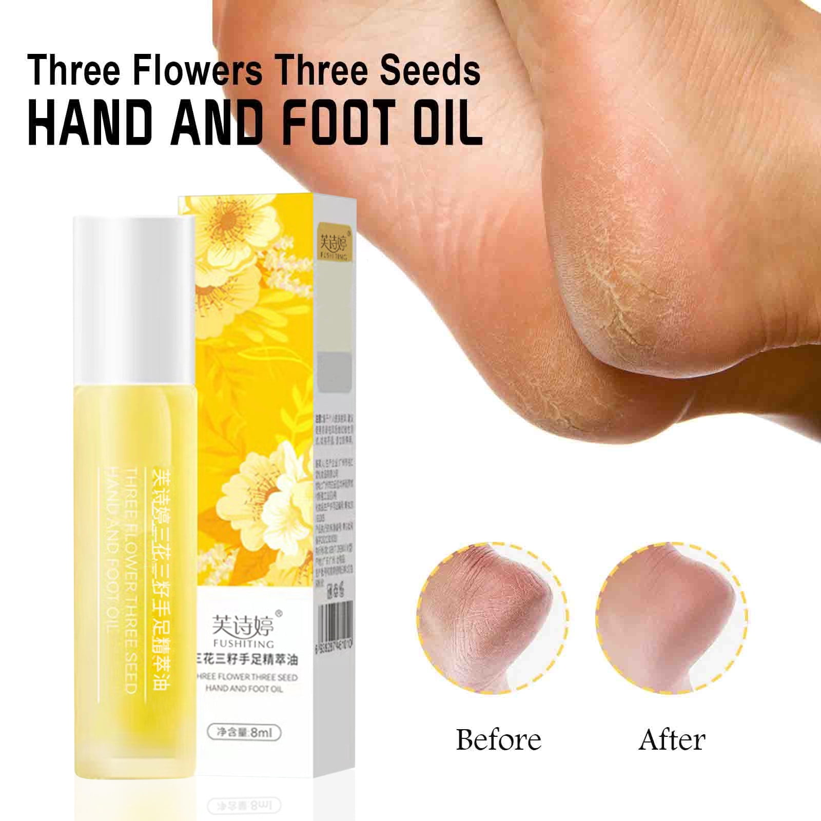 New Release, Three-Flower Hand and Foot Oil 8mlRepairs Chapped and Dry ...