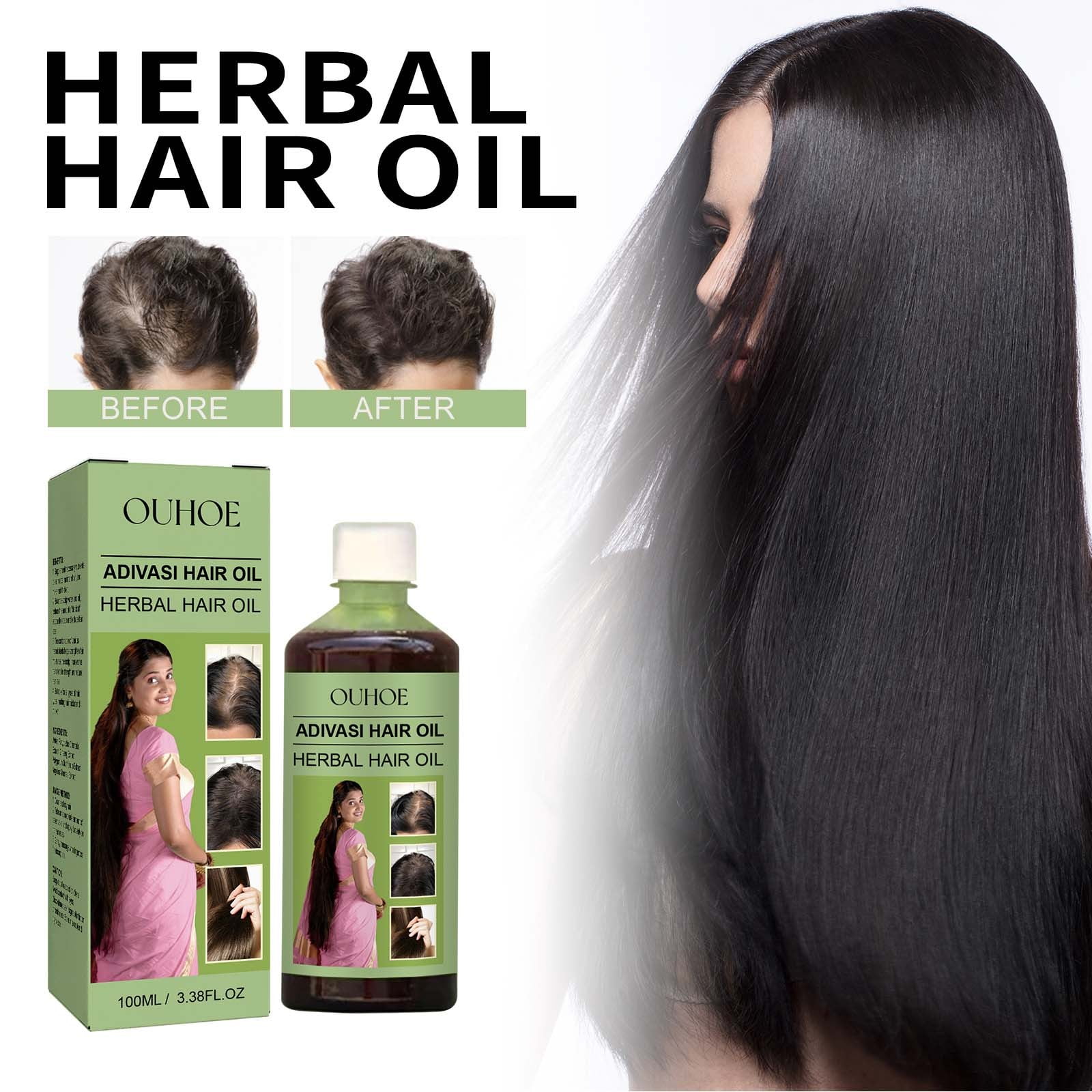 New Year Savings Under $15 100Ml Herbal Hair Oil Refreshing Non-Greasy ...