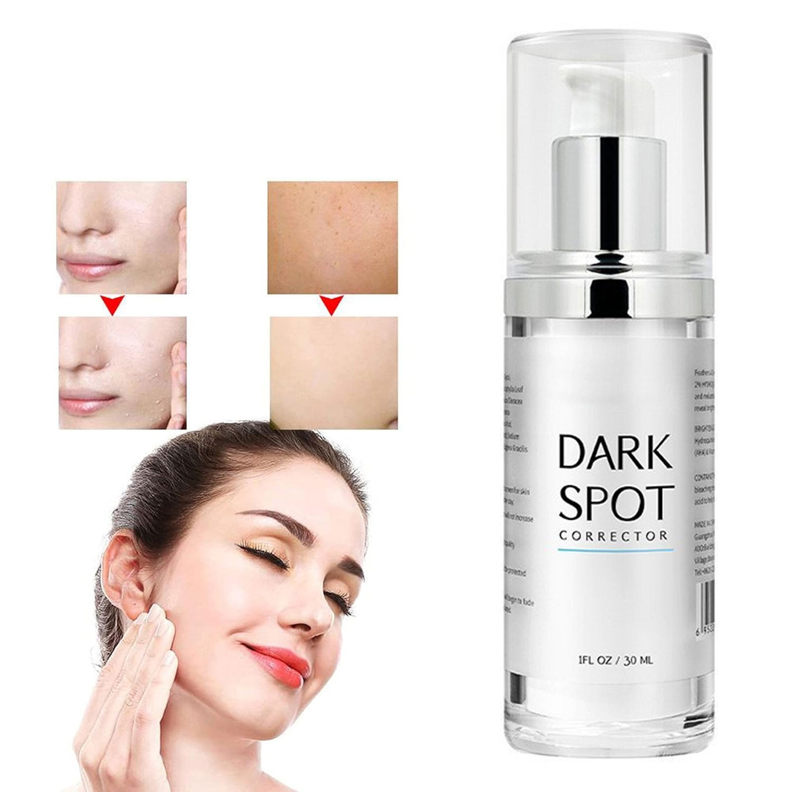 Newly Upgraded Face Removing Penetrates Deep Into Skin To Fade ...