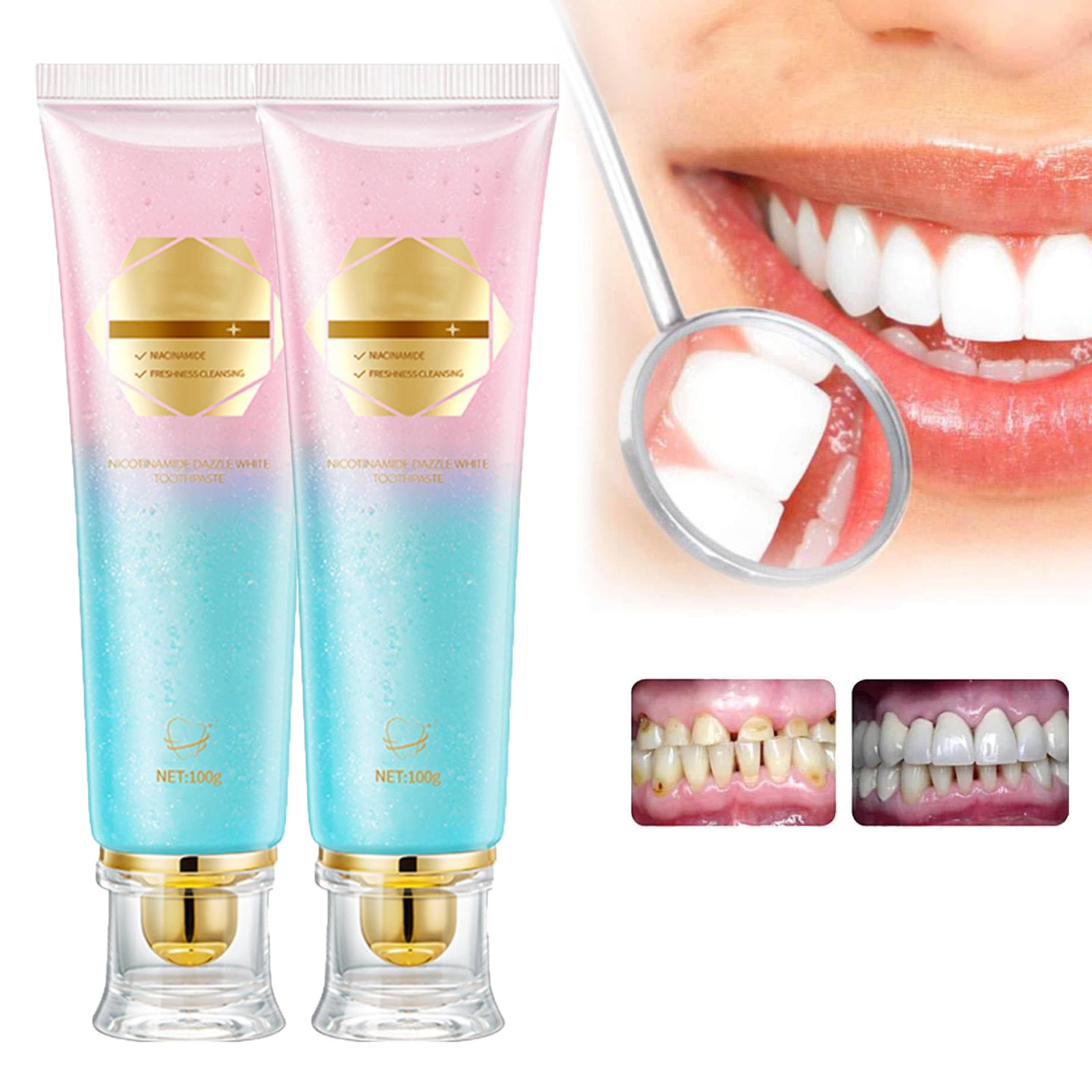 Niacinamide Toothpaste, 2 Pack Niacinamide Brightening Toothpaste ...