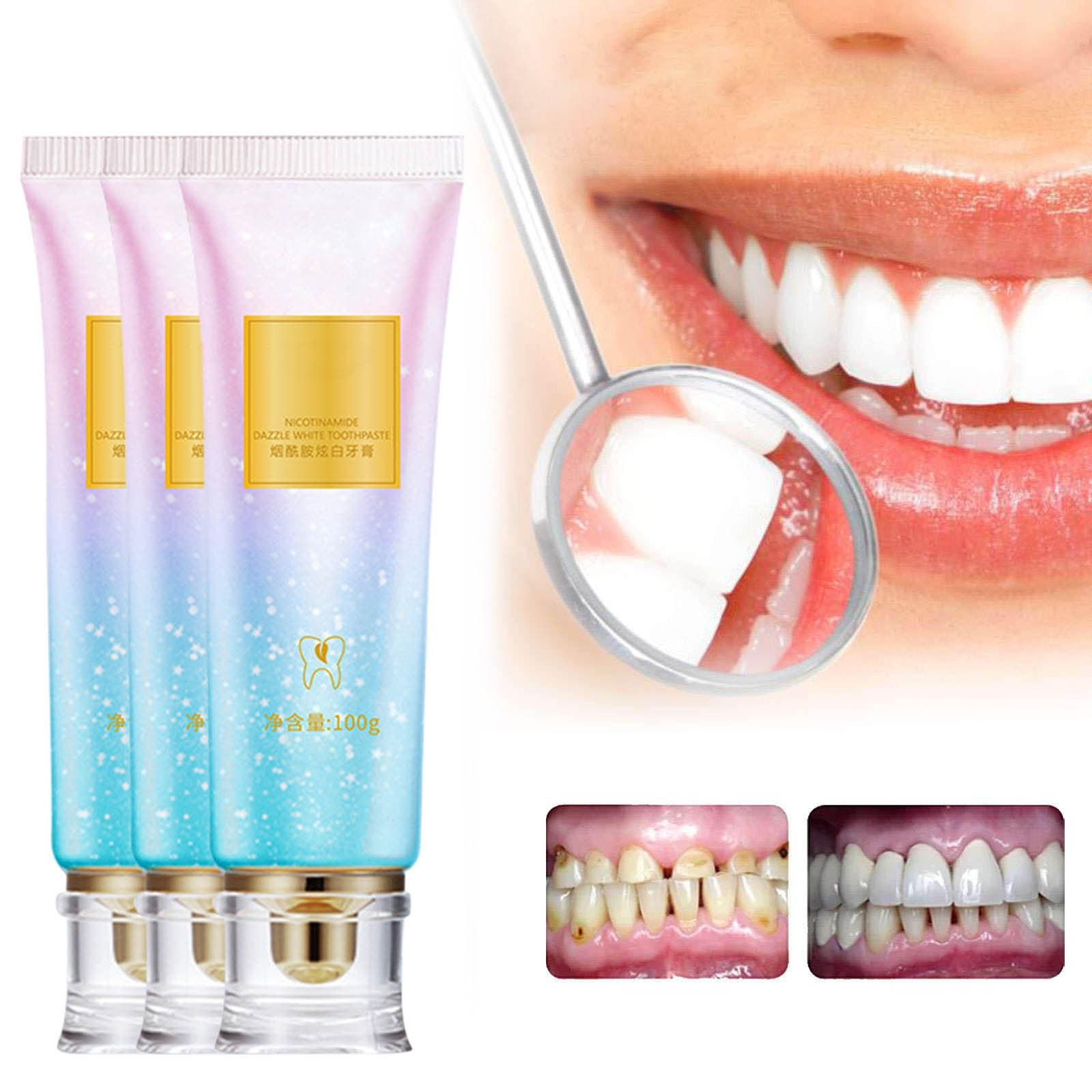 Niacinamide Toothpaste 3Pcs, Niacinamide Whitening Toothpaste, Fresh ...