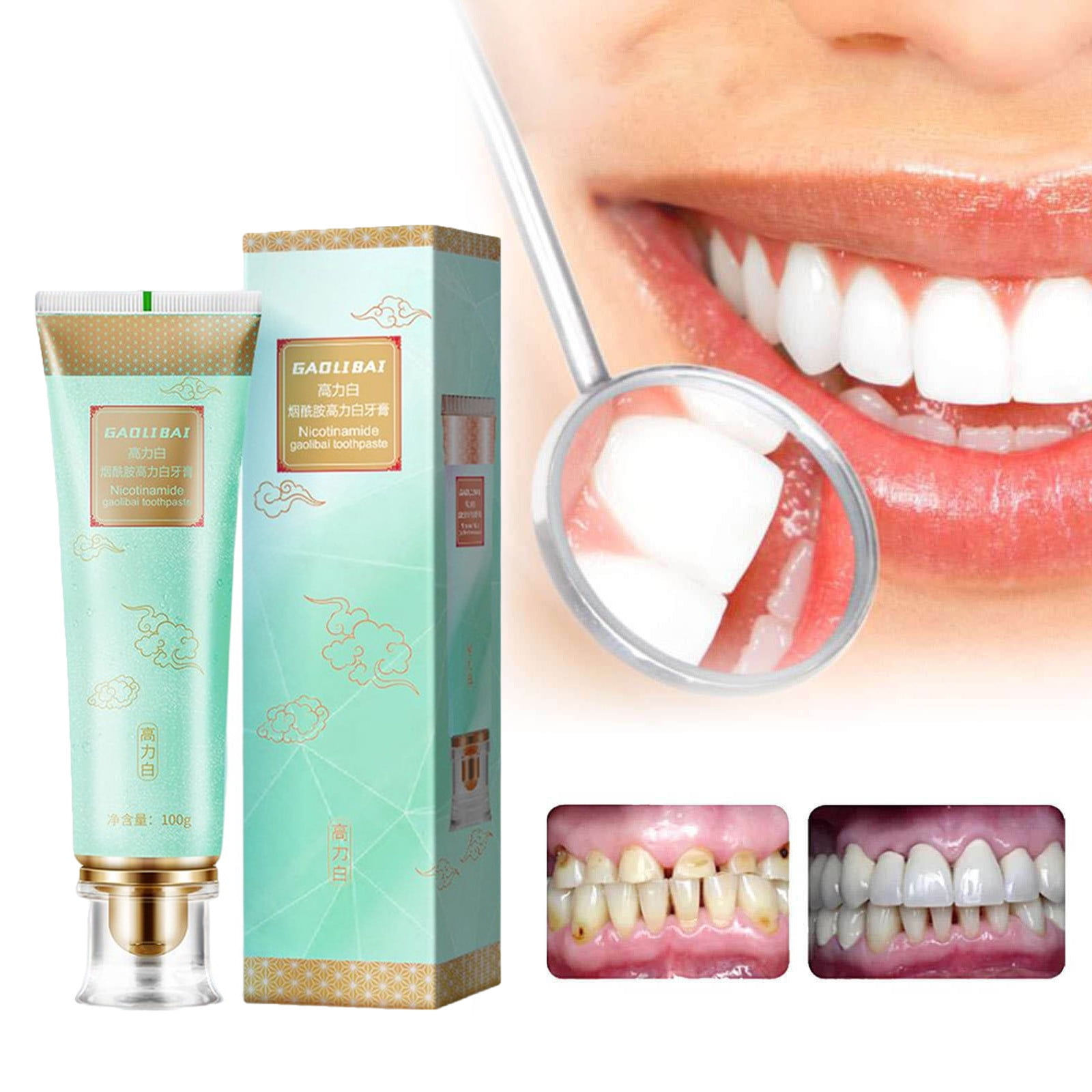 Niacinamide Whitening Toothpaste 100g/3.5oz, Teeth Whitening Toothpaste ...