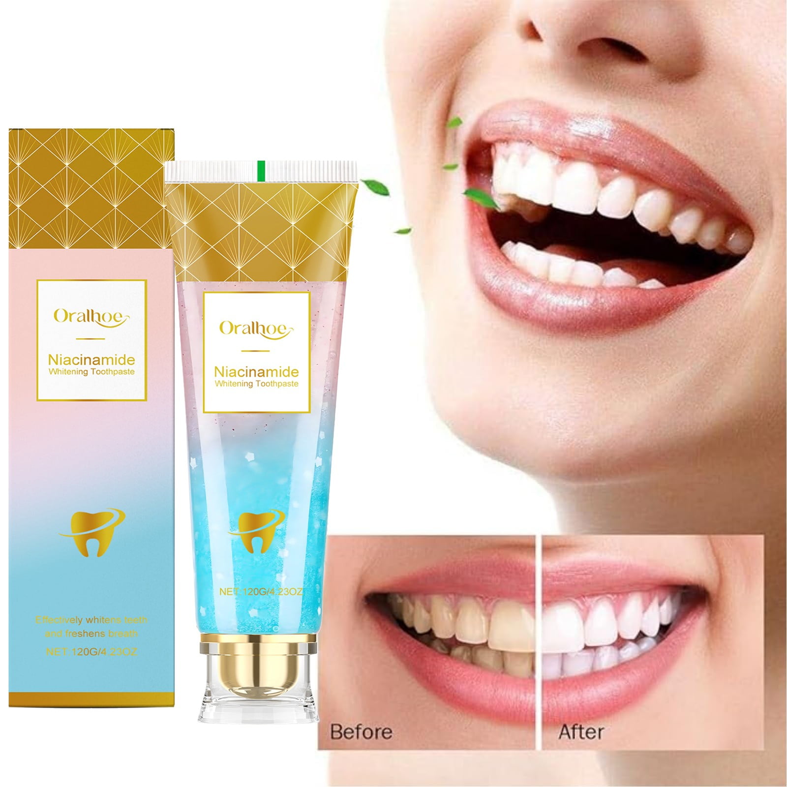 Niacinamide Whitening Toothpaste – Enamel Repair & Stain Removal ...