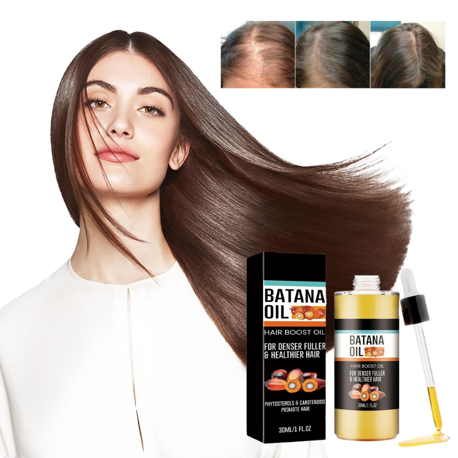 Niaviben Hair Care,Battana Oily Hair Care Set Nourish Hydrate And ...