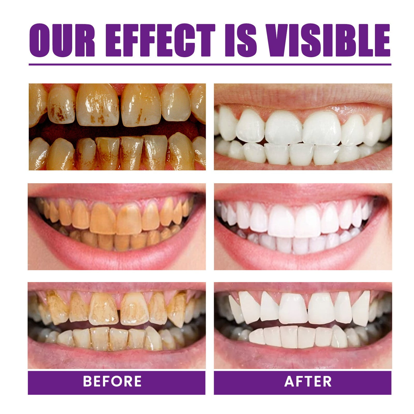 Niceme Purple Toothpaste For Teeth Teeth Toothpaste Purple Toothpaste ...