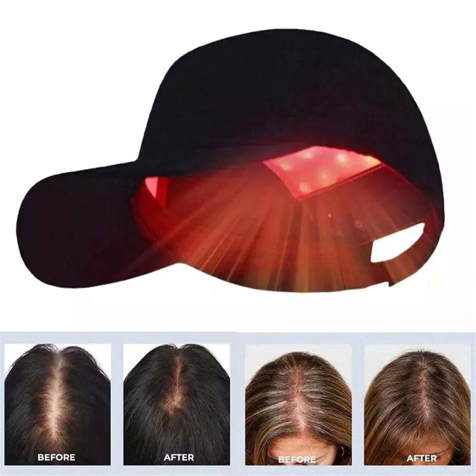 Niceme Red Light Hair Hair Cap Solid Hair Anti Hair Loss Oily Hair ...