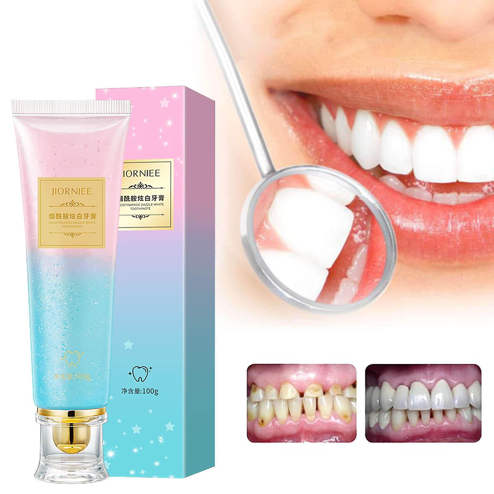 Nicotinamide Whitening Toothpaste Cleaning Fresh Breath Bright Tooth ...