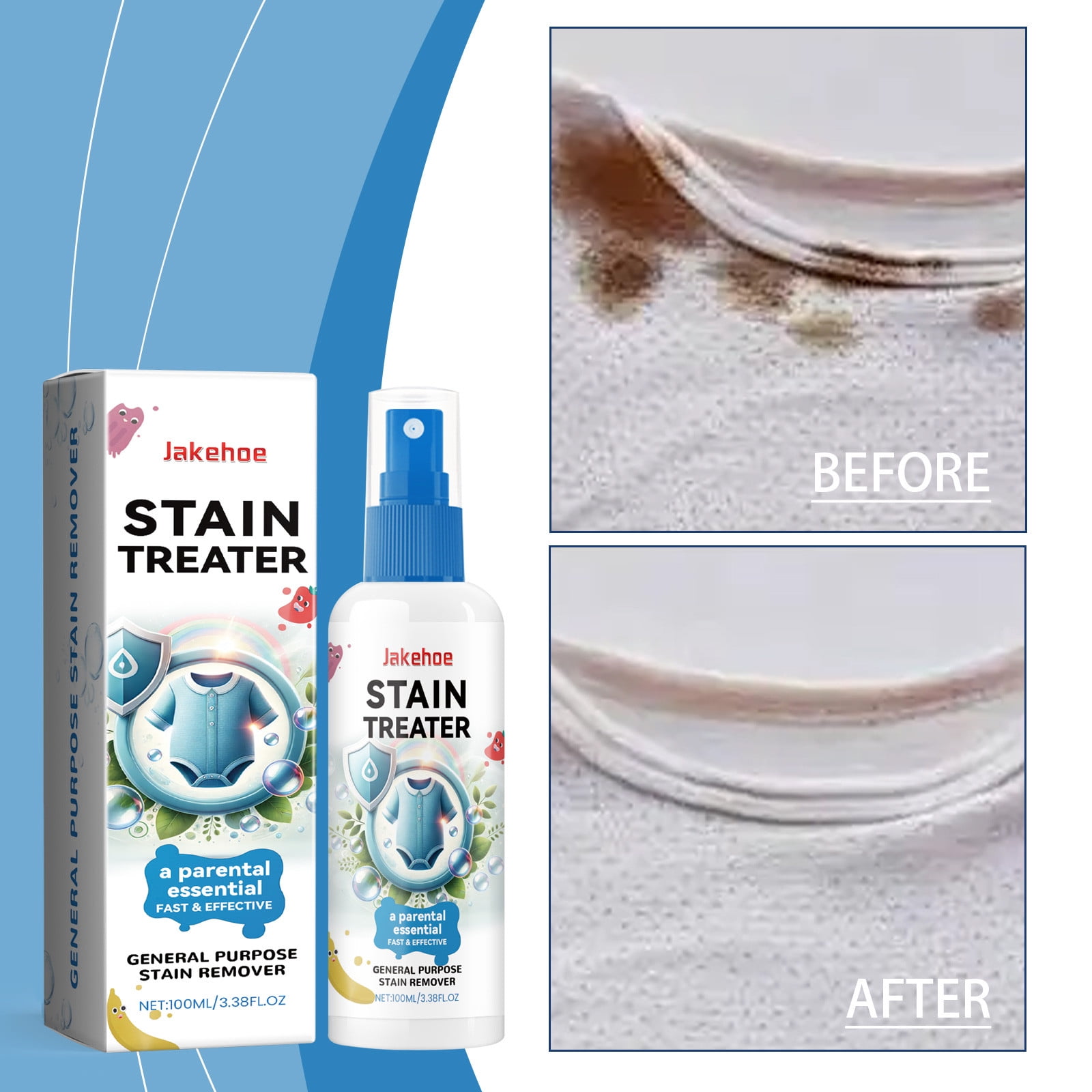 Nilvkv General Purpose Stain Remover Laundry Stain Remover Spray ...