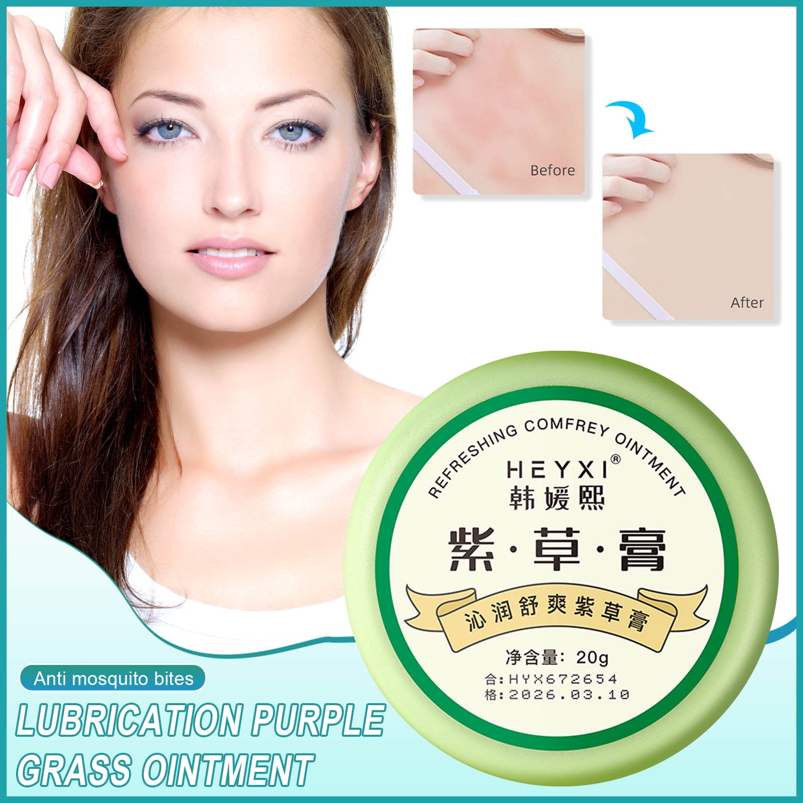 Njagoc All-Natural& Itch Cream - Safe For Kids And Infants Ticks ...