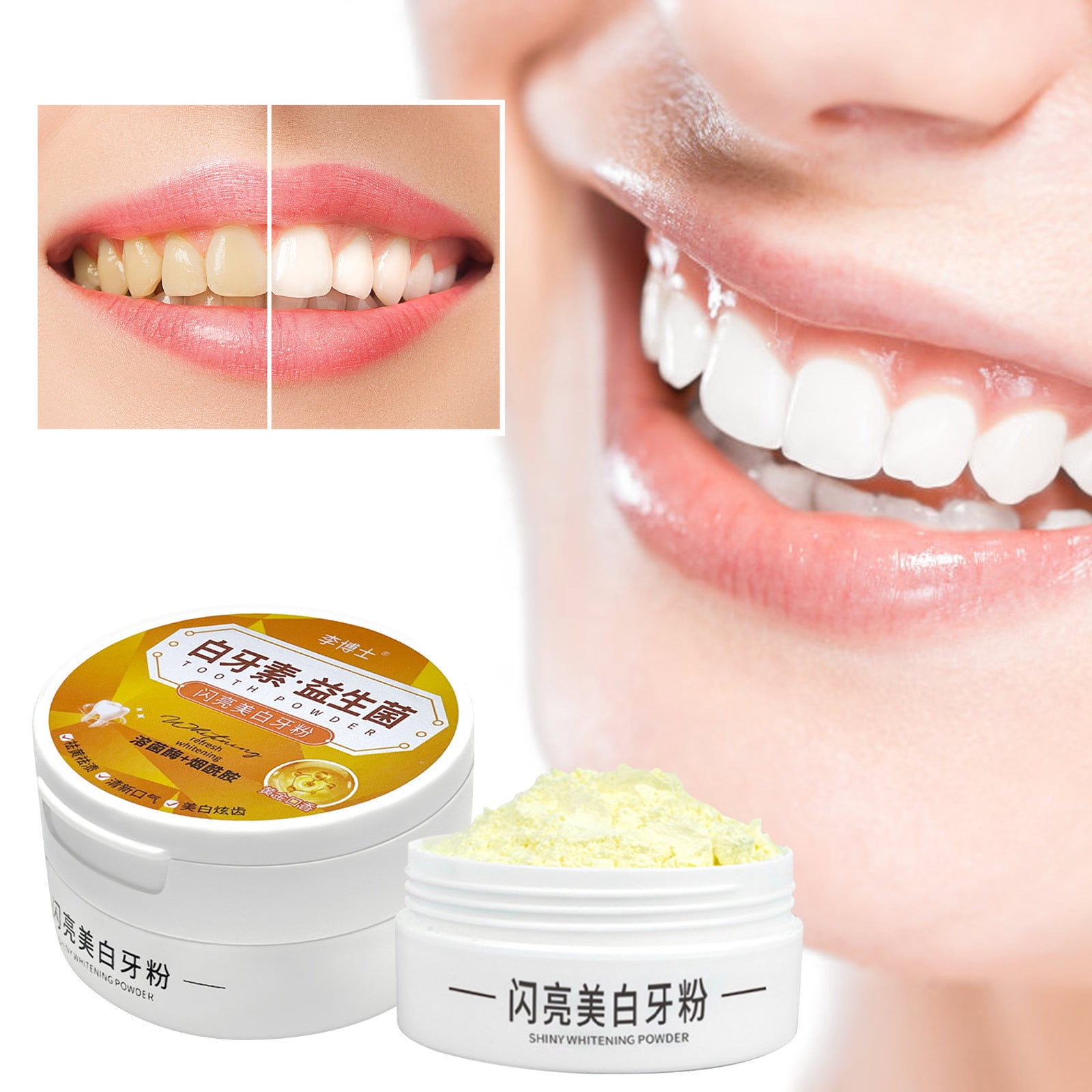 Njoeus Snow Tooth Powder, Teeth Cleaning PowderRemove Yellowing And ...