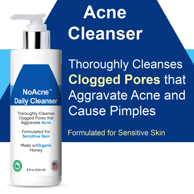 NoAcne Gel Cleanser for Acne, Blackheads, Pimples and Breakouts ...