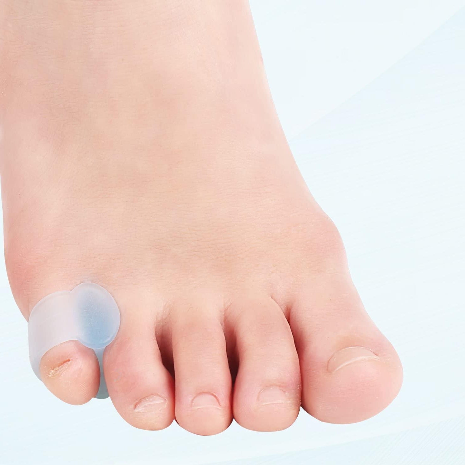Nololo Pinky Toe Splint 10 pcs, gel toe separators, hammer toe little ...