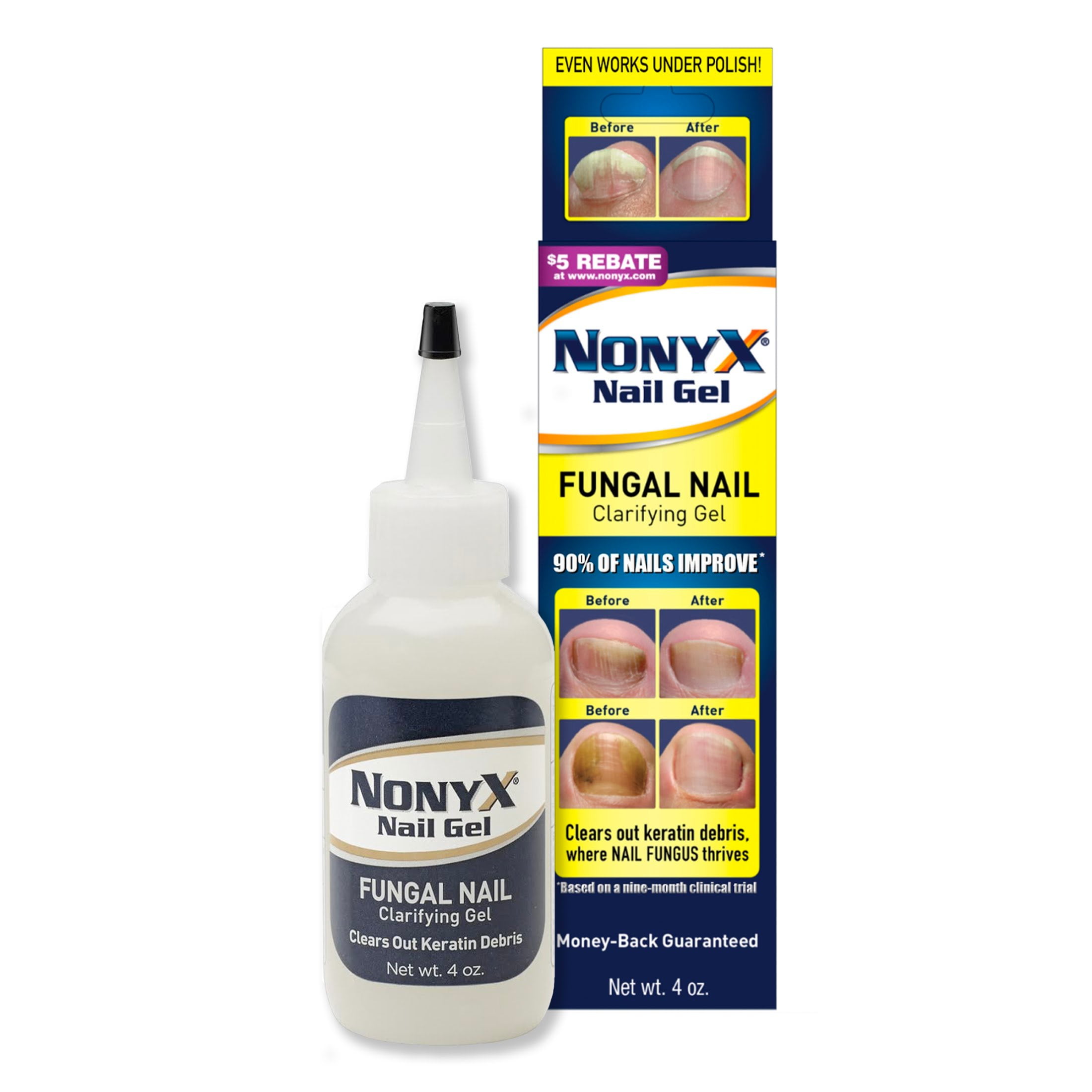 NonyX Fungal Nail Clarifying Gel, 4 oz - Walmart.com
