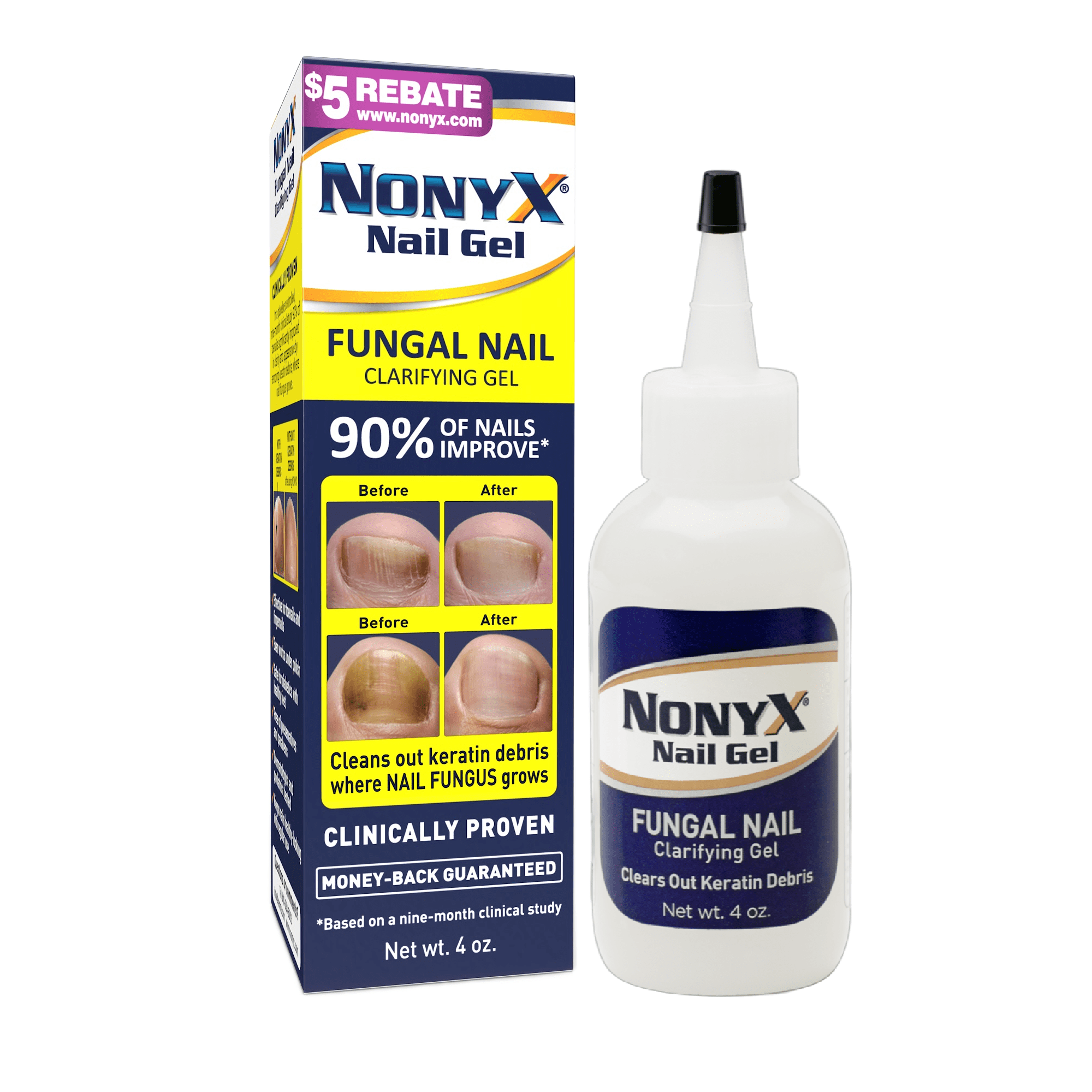 Nonyx Nail Gel, a Clinically Proven Treatment for Fungus-Damaged Nails ...